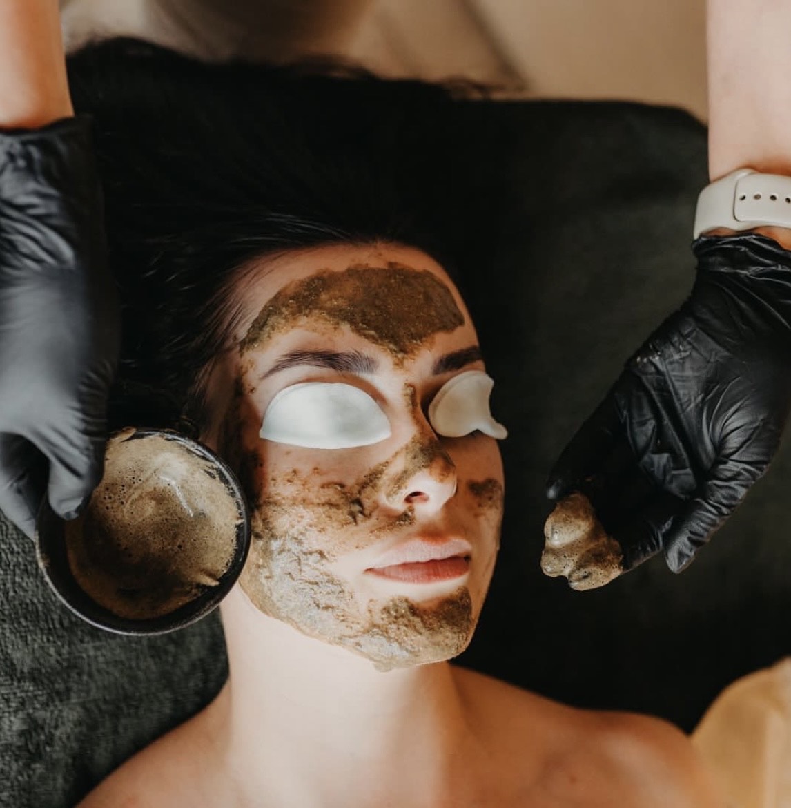 Algae Peel Lichfield | Algae Peel Tamworth | Skin Health Clinic