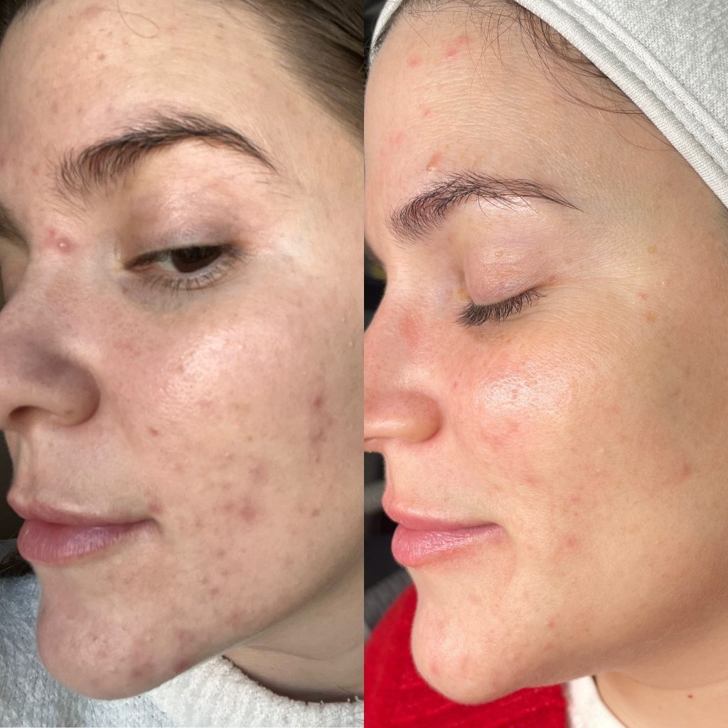 DPL Lichfield | Skin Health Clinic